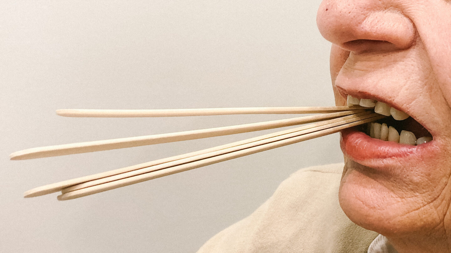 saskatoon-trismus-treatment - North 49 Physical Therapy, Balance ...