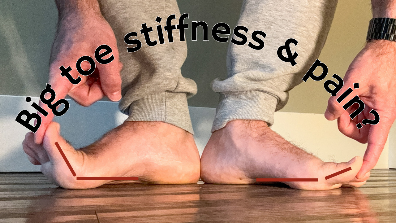 Hallux Rigidus & Hallux Limitus - North 49 Physical Therapy, Balance ...